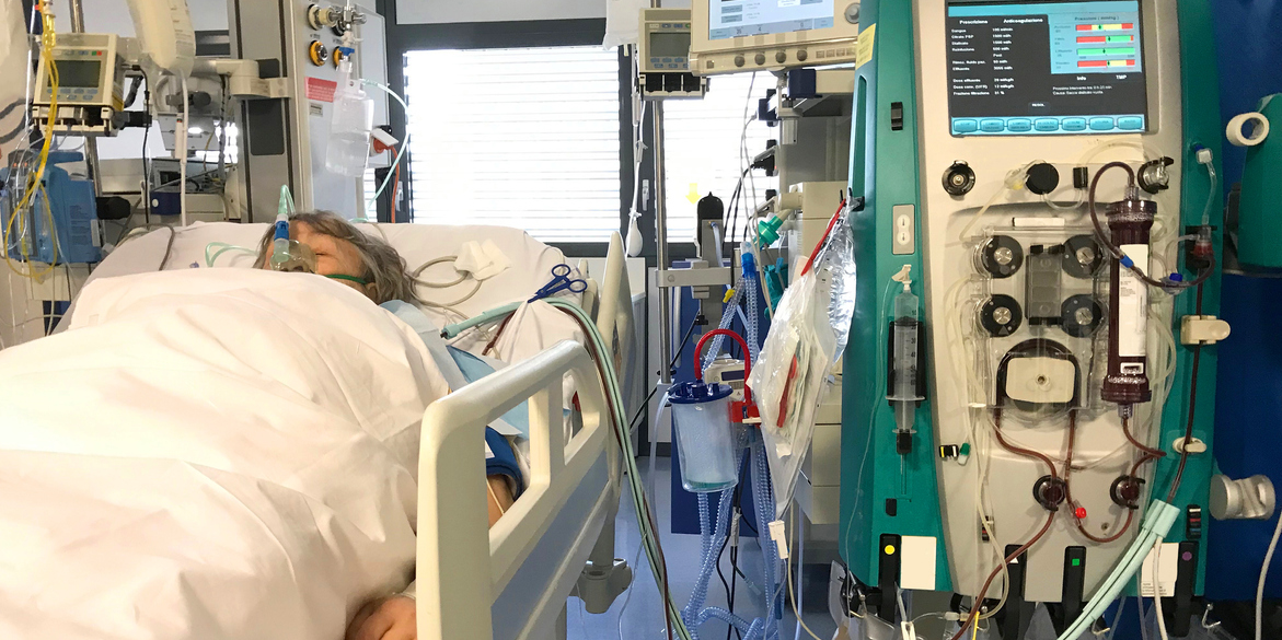 Long road to recovery after septic shock, especially for women | The ...