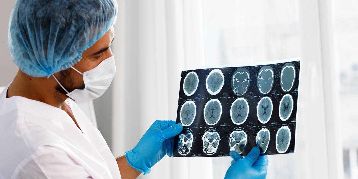 Large stroke trial finds intensive blood pressure lowering after clot ...